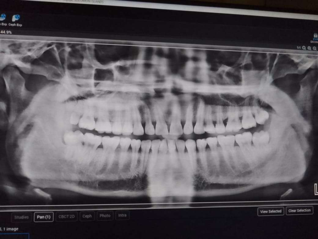 GALE – A VICTIM OF LAW ENFORCEMENT THUGGERY? - Solomon Star News